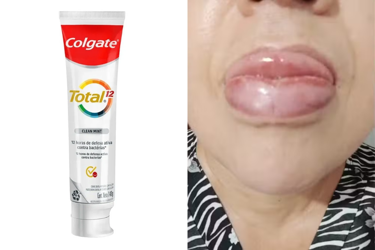 Colgate continua com pasta suspensa após mil reclamações