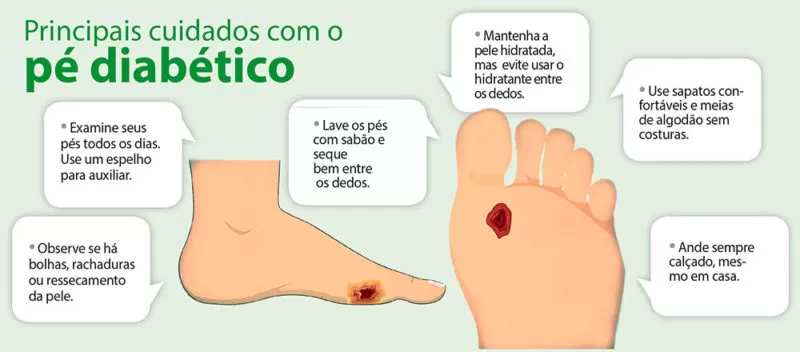 Tratamento do pé diabético, o que você precisa saber